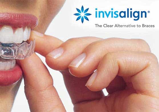 Invisalign Perfect Smiles Dental Care Lenexa